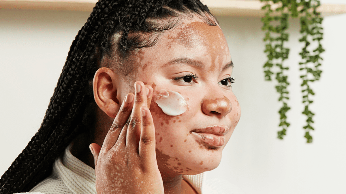 Ingredients Lab: What Is Allantoin Used For In Skincare? - Ameliorate